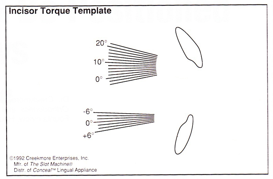 Optimum Teeth Positioning Based on Maxillary Incisors