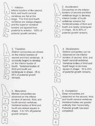 Efficacy of Cervical Vertebrae as Maturation Indicators