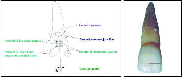 Congruent Surfaces Based Bonding System