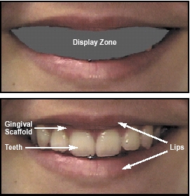 Smile Analysis and Design in the Digital Era - JCO Online