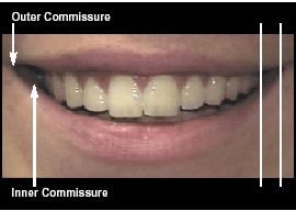 Smile Analysis and Design in the Digital Era - JCO Online