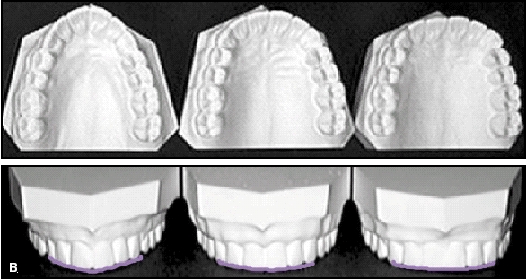 Smile Analysis and Design in the Digital Era - JCO Online