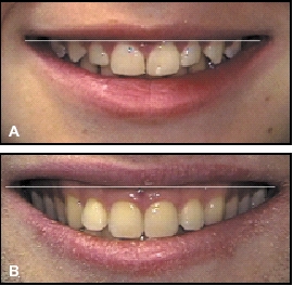 Smile Analysis and Design in the Digital Era - JCO Online