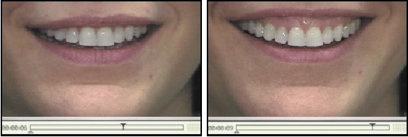 Smile Analysis and Design in the Digital Era - JCO Online