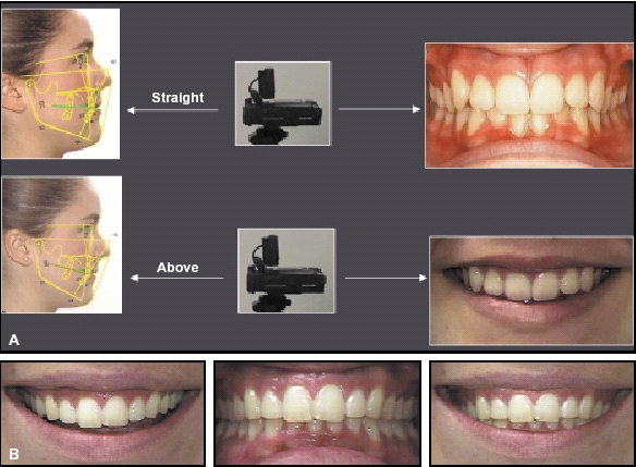 Smile Analysis and Design in the Digital Era - JCO Online