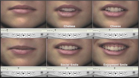 Smile Analysis and Design in the Digital Era - JCO Online