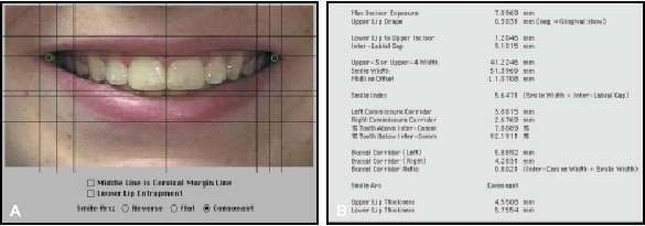 Smile Analysis and Design in the Digital Era - JCO Online