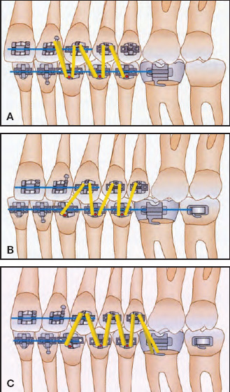 MASTER CLINICIAN R.G. "Wick" Alexander, DDS, MSD - JCO Online - Journal ...