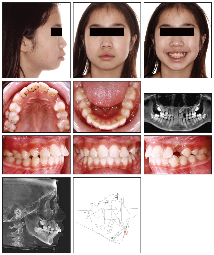 JCO Online - Journal of Clinical Orthodontics