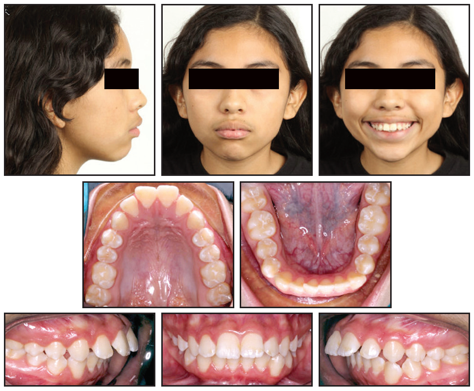 JCO Online - Journal of Clinical Orthodontics